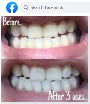Fact Check: Does whitening toothpaste actually whiten teeth? - THIP Media