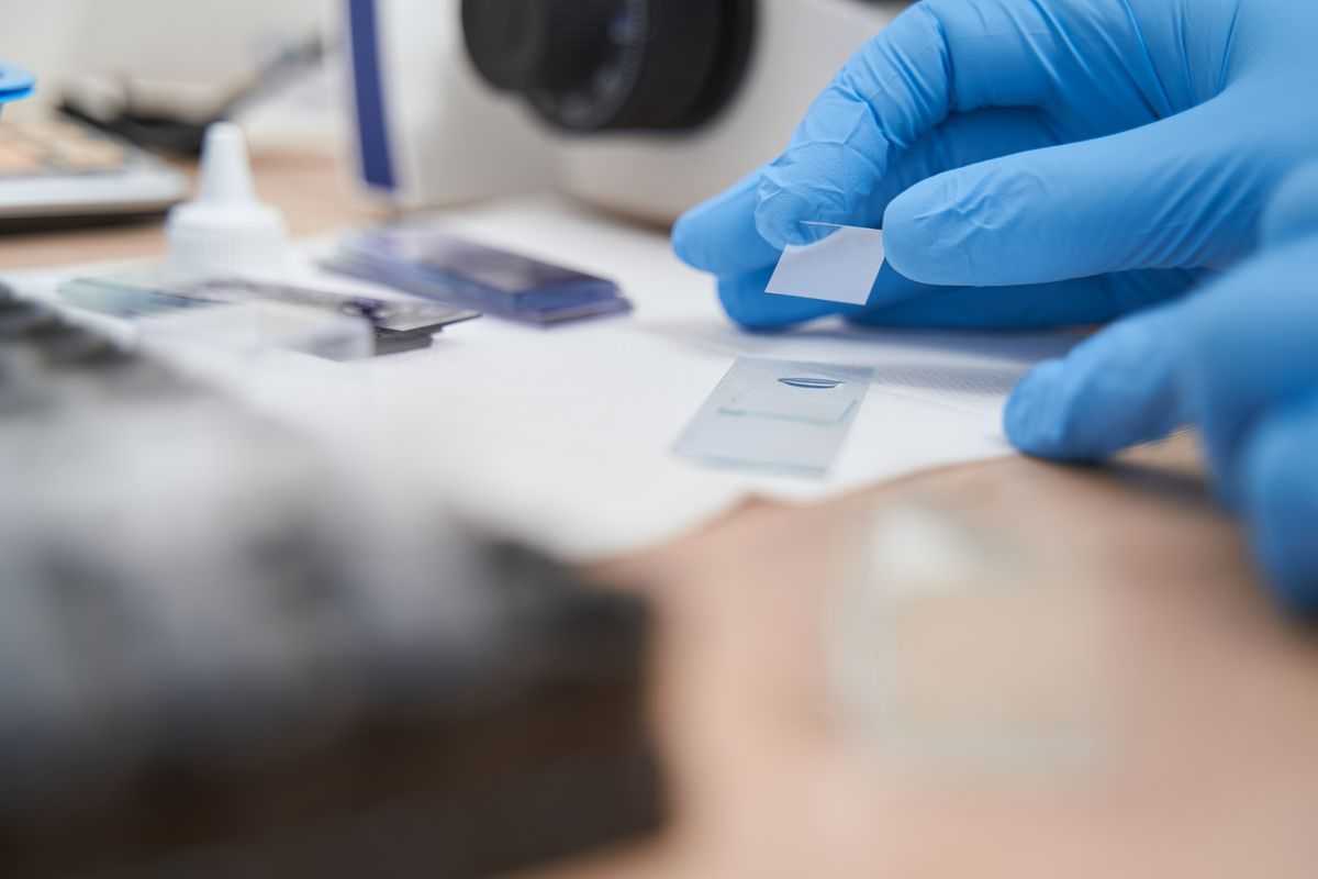 Do Tuberculosis Tests Hurt THIP Media