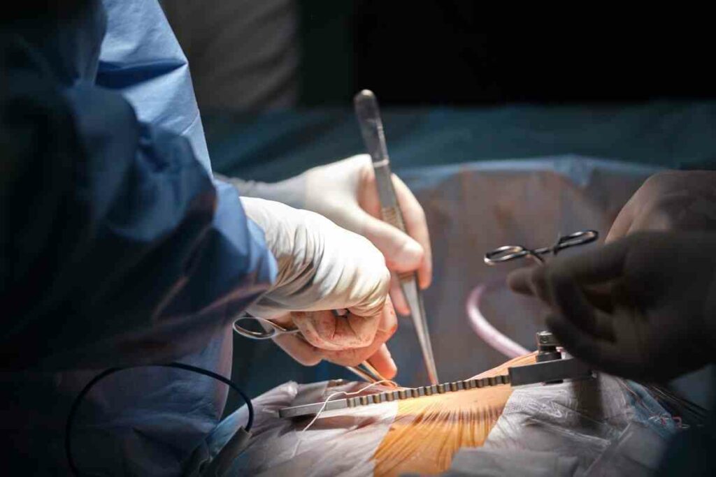 Can my appendix grow back after surgery? - THIP Media
