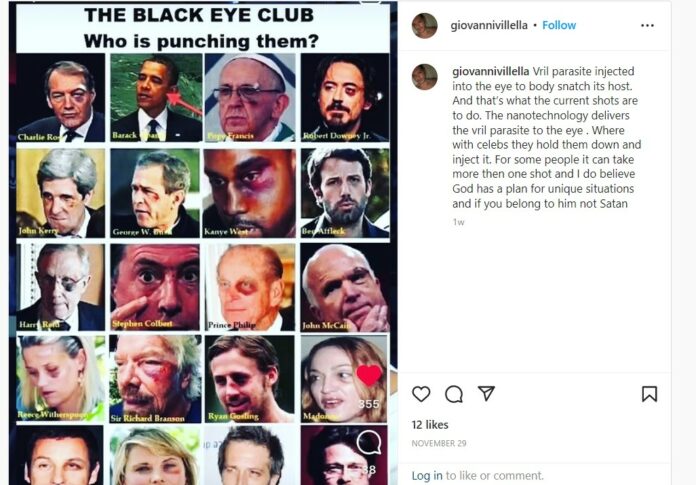 Fact Check: Is the black eye of celebrities caused by vril parasite ...