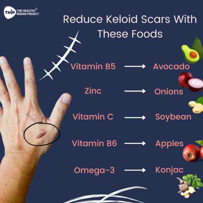 How does diet affect keloid scars?- THIP Media