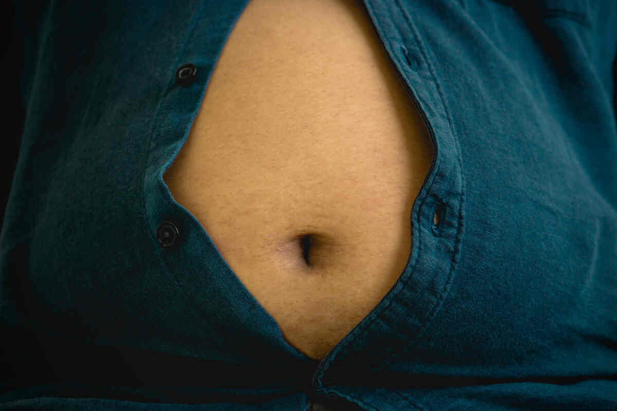 The Obesity Puzzle: A Complex Health Challenge- THIP Media