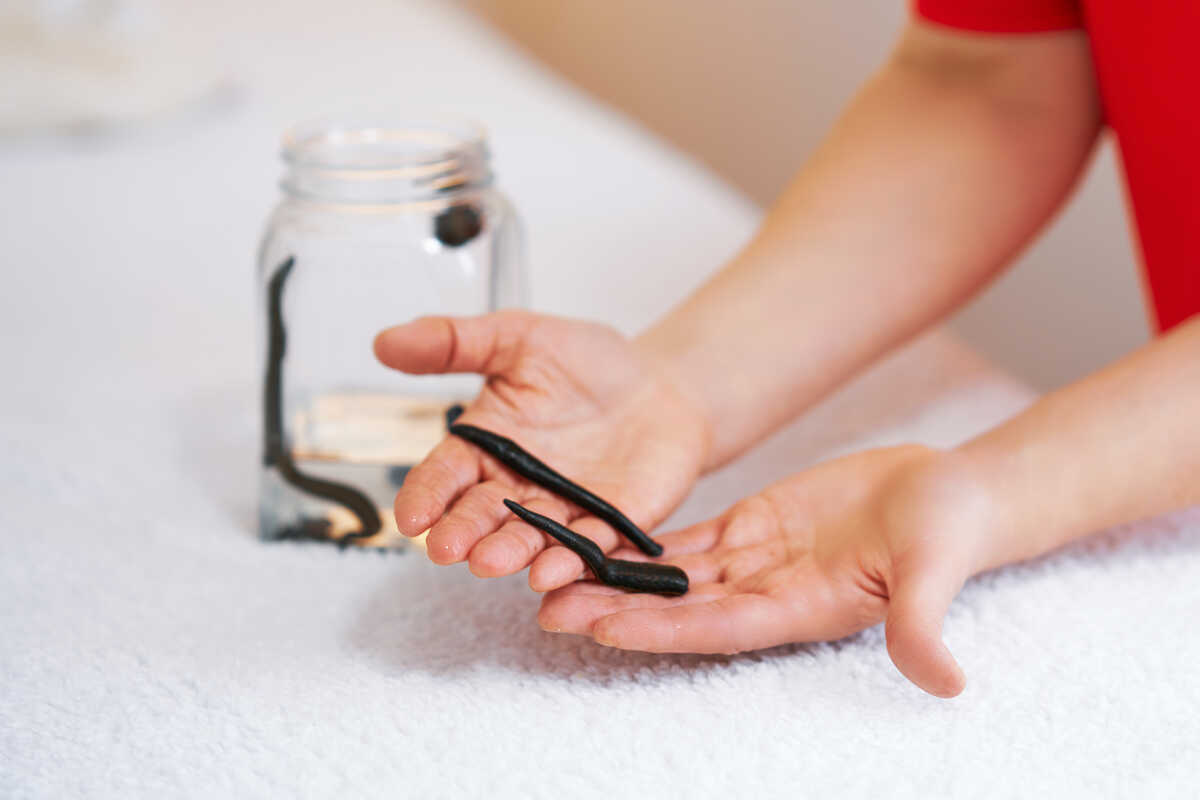 Fact Check: Can leech therapy cure acne and hyperpigmentation?